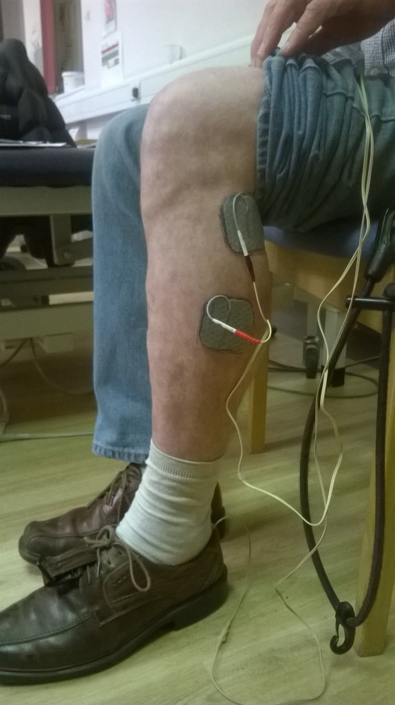 Drop Foot And The FES - Aid4Disabled